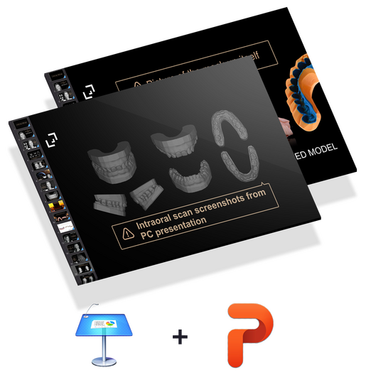 Digital Smile Design Dsd template keynote 9
