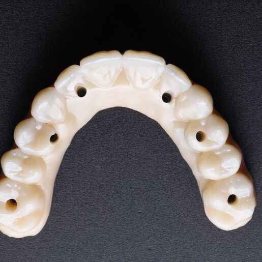 Full Arch Implant Bridge Manufacture (B Components)