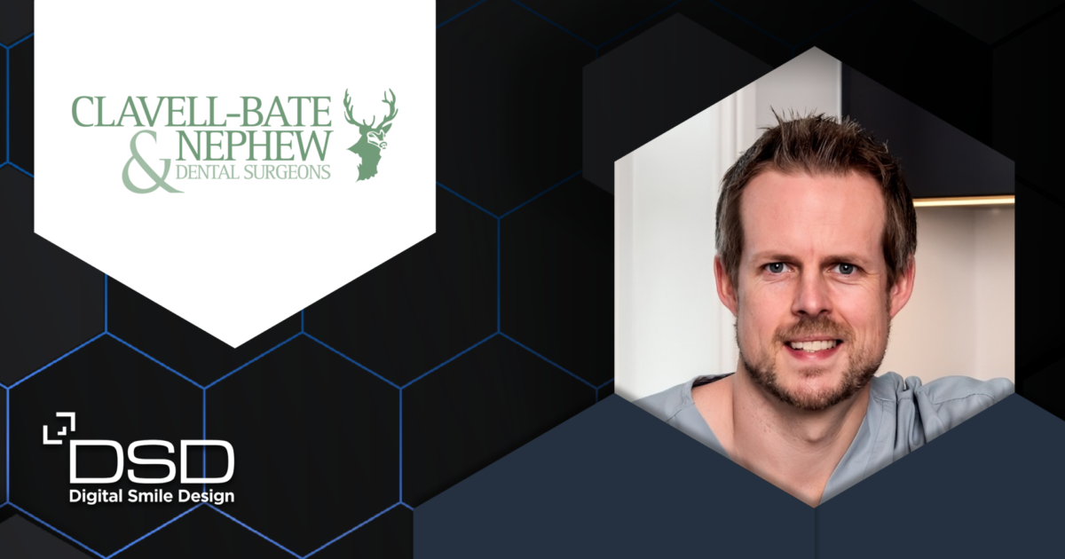 Elevating Dental Care: Dr Clavell-Bate's Success with DSD