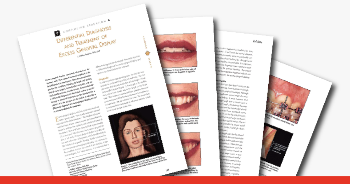 Differential Diagnosis and Treatment of Excess Gingival Display