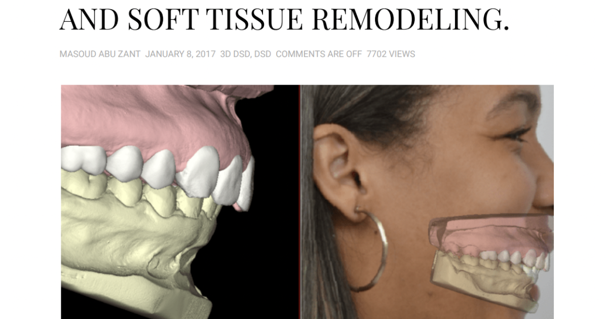 Dimensions of the dentogingival tissue