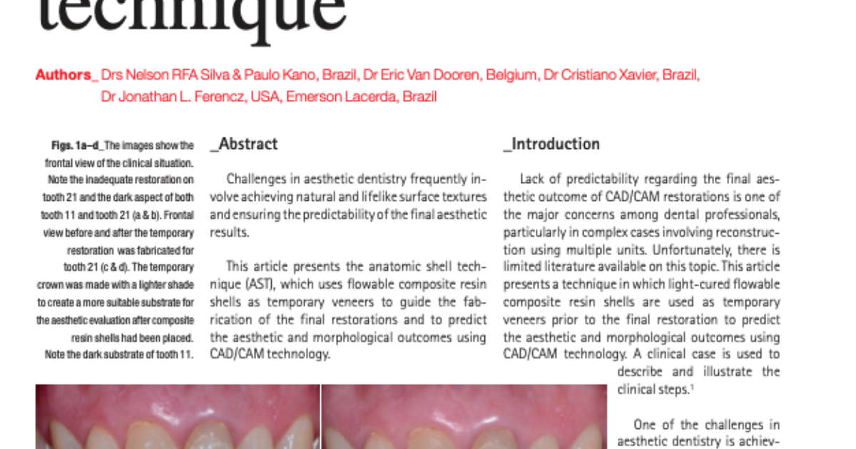 Improving aesthetics in CAD/CAM dentistry – anatomic shell technique