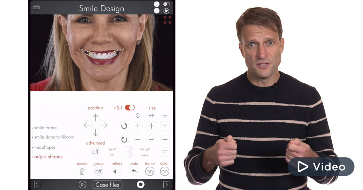 Enhance Dental Practice with Free DSD App | Smile Design Simplified