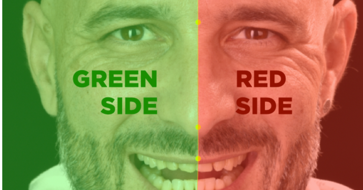 Clinical article: The Facial Flow Concept