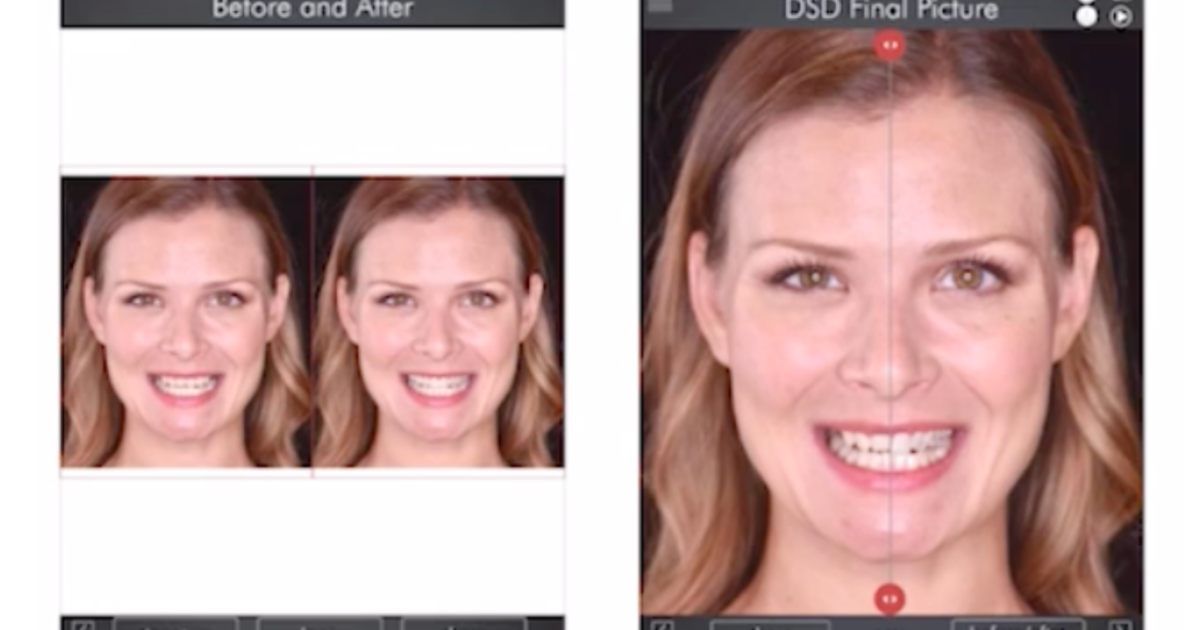 Why should I pay for a DSD course when I can design smiles on the DSD…