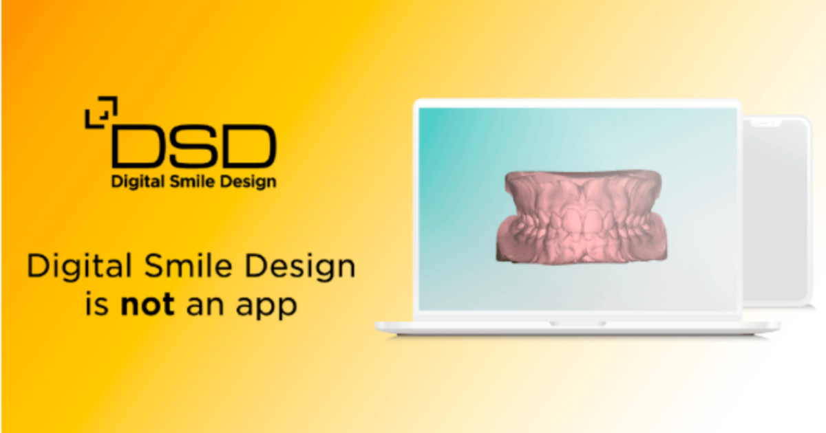 Is Digital Smile Design an app?