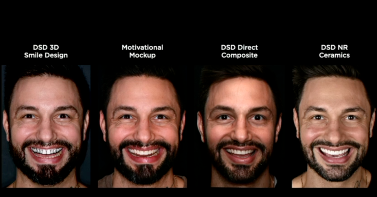 Clinical article: Interdisciplinary guided dentistry, digital quality…