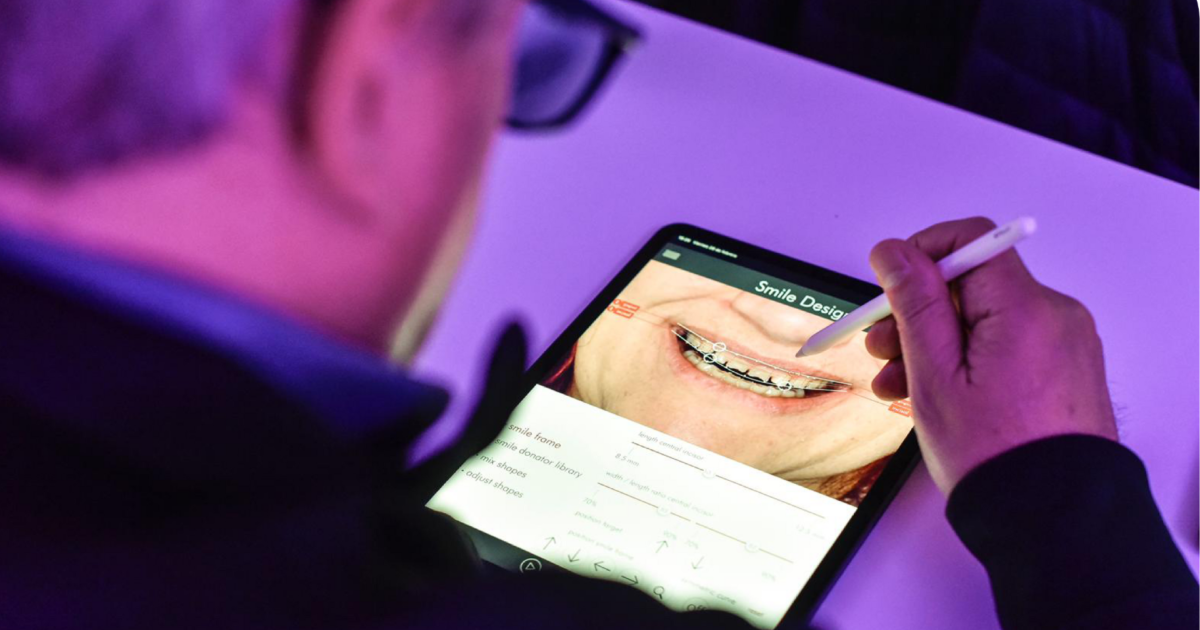 Simulate smiles easily with the DSD App