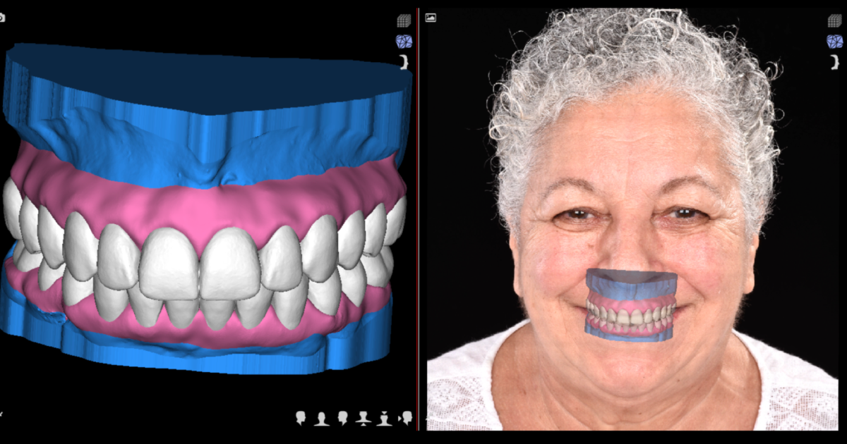 Digital dental treatment planning vs digital procedure planning: how…