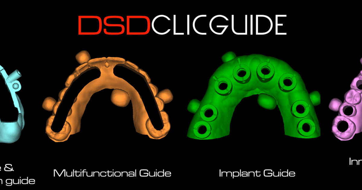 DSD Clic Guide Manufacture