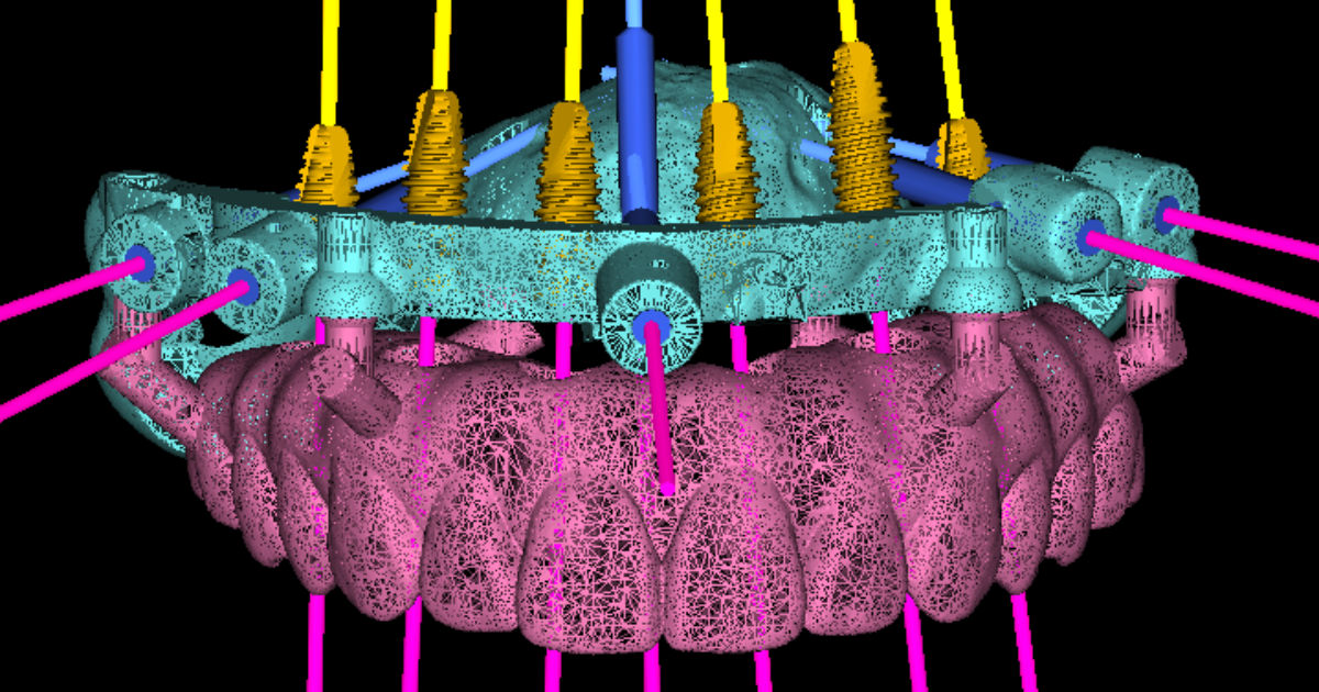 DSD Clic Guide Design