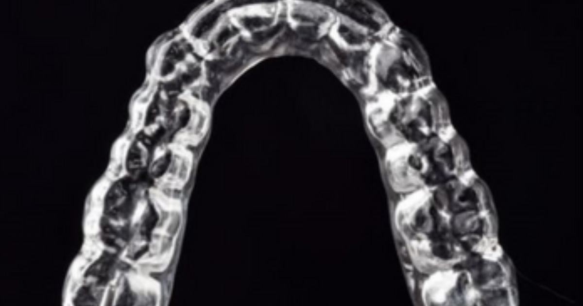 DSD Bite Splint Manufacture