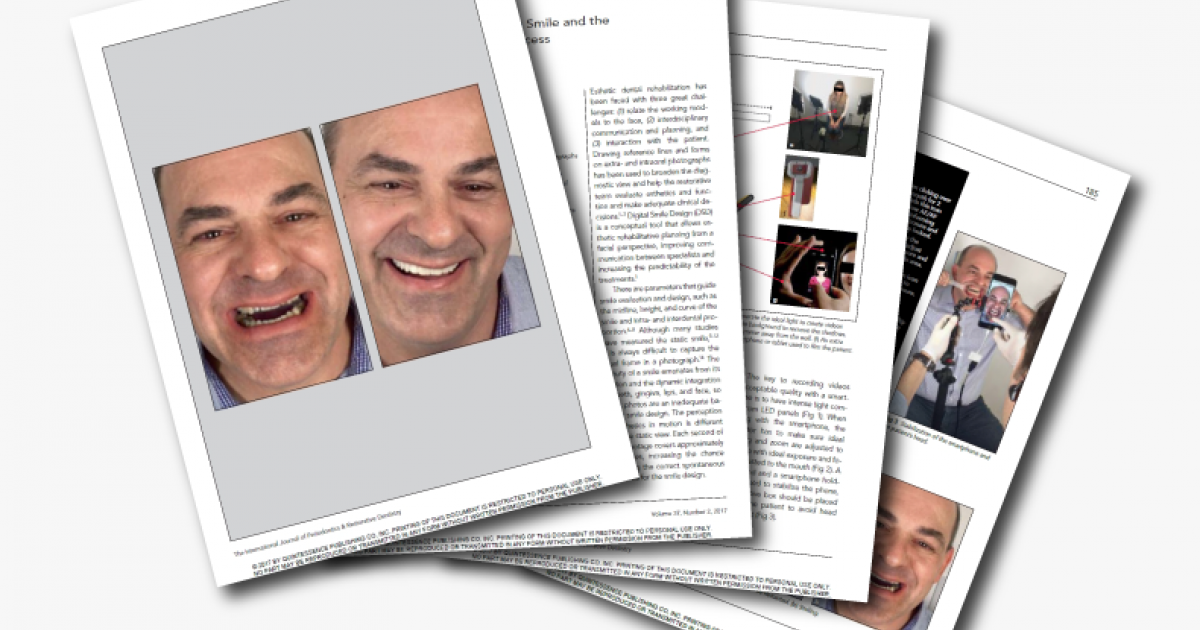 Dynamic Documentation of the Smile and the 2D/3D Digital Smile Design…