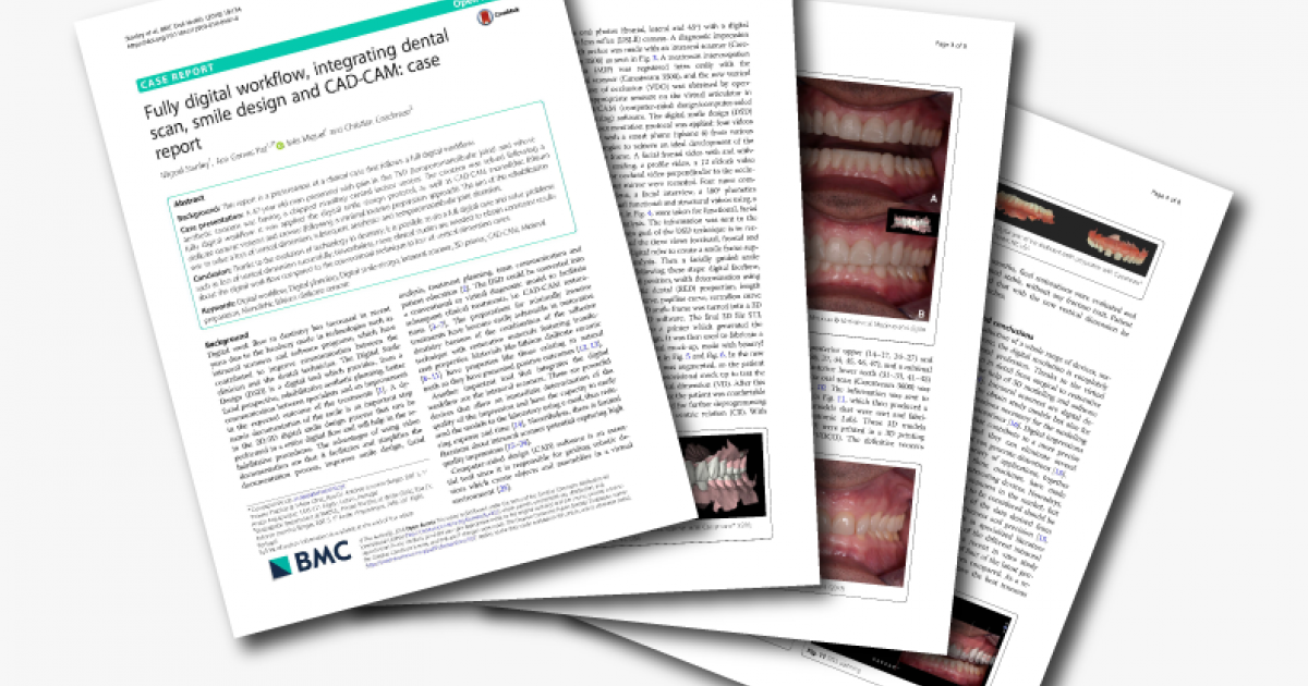 Fully digital workflow integrating dental scan smile design and…