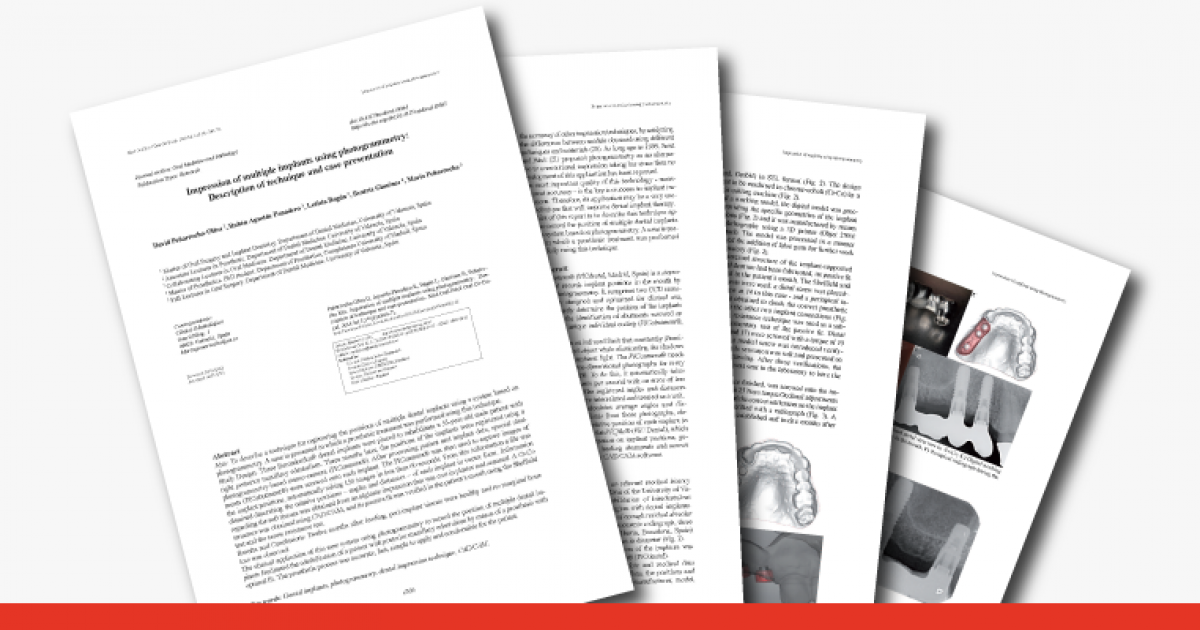 Impression of multiple implants using photogrammetry: Description of…