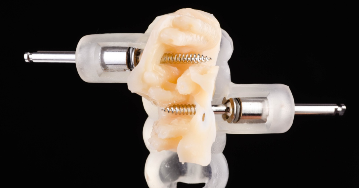 How can the DSD TAD Guide transform your ortho cases?